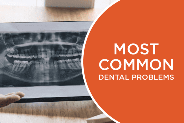 Most common dental problems - Delta Dental of Wisconsin Blog